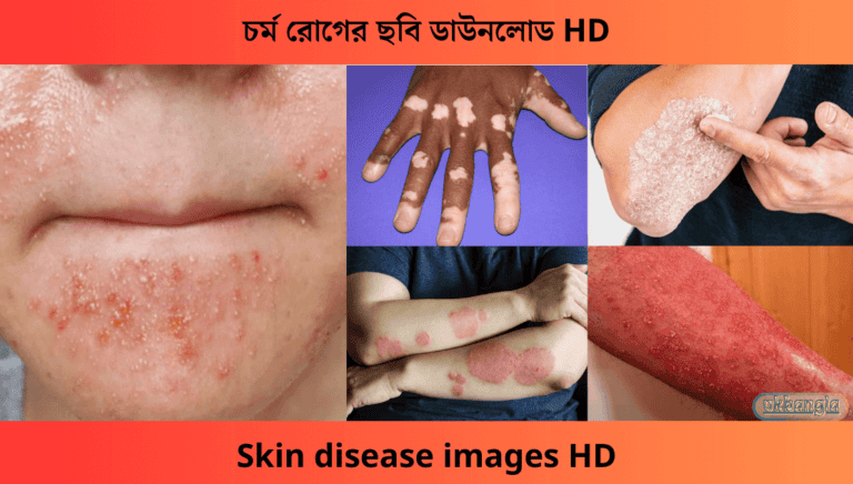 225+চর্ম রোগের ছবি ডাউনলোড HD/ Skin disease images HD