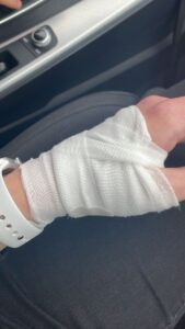 325+হাতে ব্যান্ডেজ করা ছবি ডাউনলোড , Hand bandage pictures