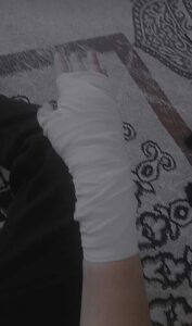 325+হাতে ব্যান্ডেজ করা ছবি ডাউনলোড , Hand bandage pictures