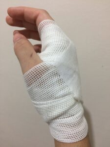 325+হাতে ব্যান্ডেজ করা ছবি ডাউনলোড , Hand bandage pictures